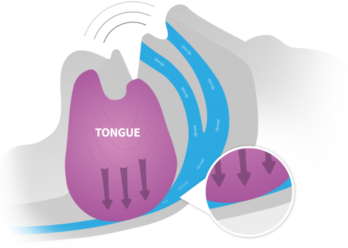 How eXciteOSA® can help - eXciteOSA